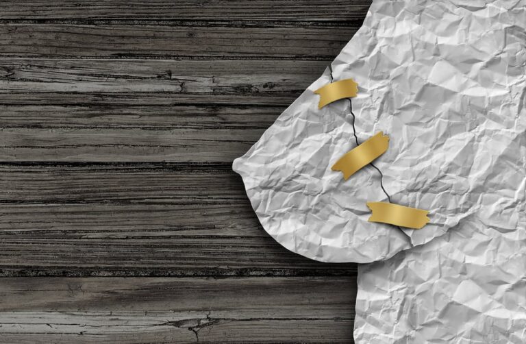 Tissue Expanders: What They Look Like, Implant Exchange, and Risks