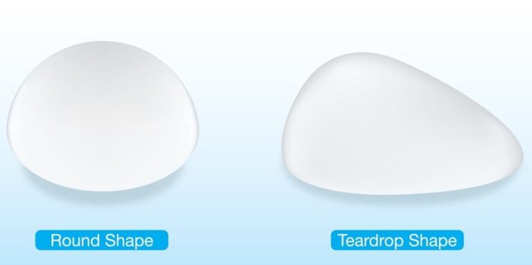 Teardrop or Round? Breast Implant Shapes: A Glossary of Terms