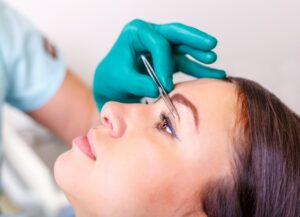 Triple Eyelid: What It Is and What Can Be Done About It