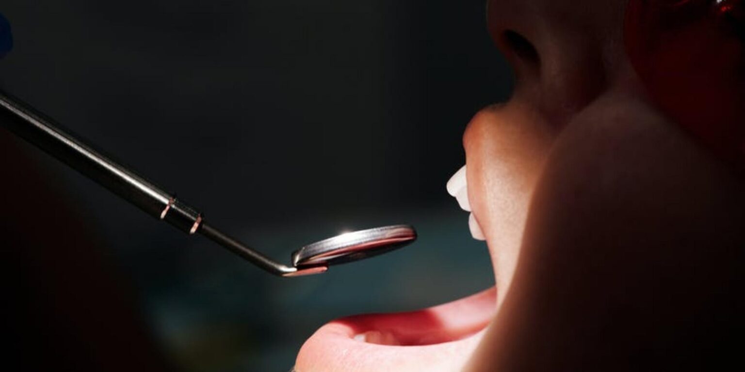 Weak Enamel: How To Spot It?weakk - Zwivel